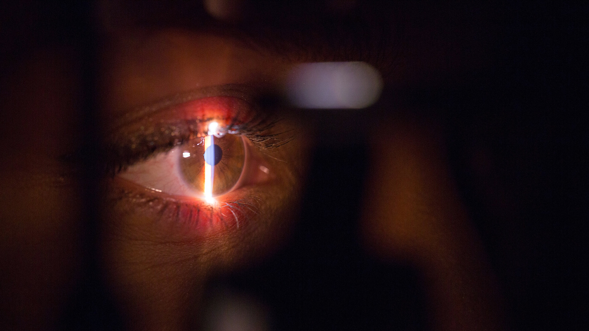 The eye: a window into brain cardiovascular disease | The Alan Turing ...